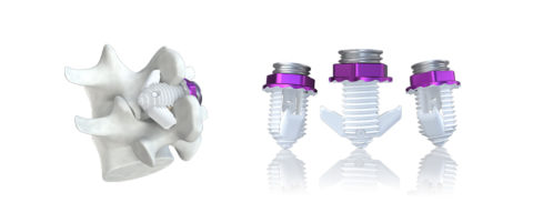 The Minuteman® Procedure | Spinal Simplicity