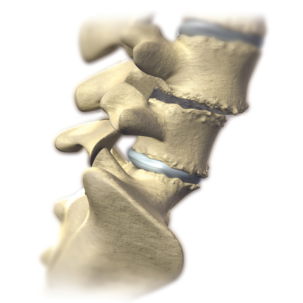 Patients Information | Spinal Simplicity